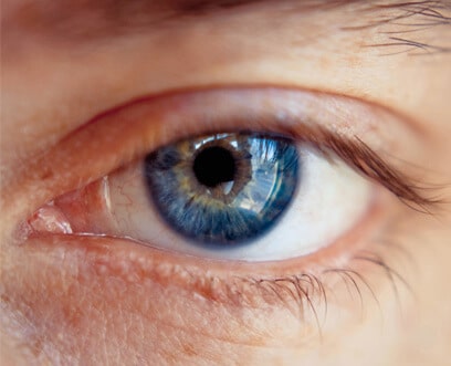 Lockdown eye strain - what you can do to help your eyes now - Optilase